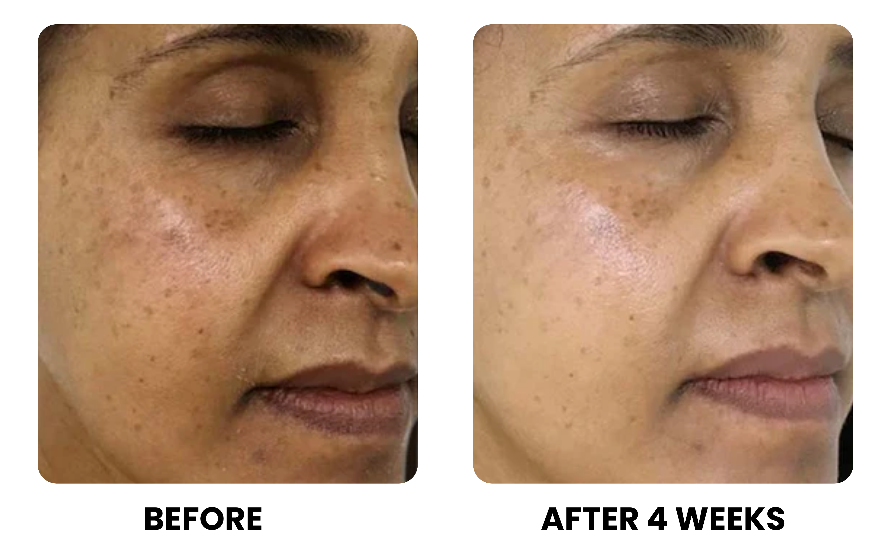 But after just one month of incorporating collagen protein into her ...